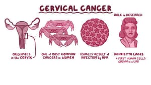 Cervical Cancer Screening: 3 Things Every Woman Should Know